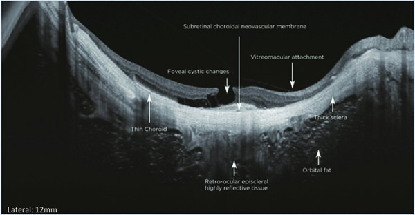 Topcon TRITON /TRITON PLUS – Optik Medikal