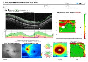 3D OCT-1 MAESTRO2 – Optik Medikal
